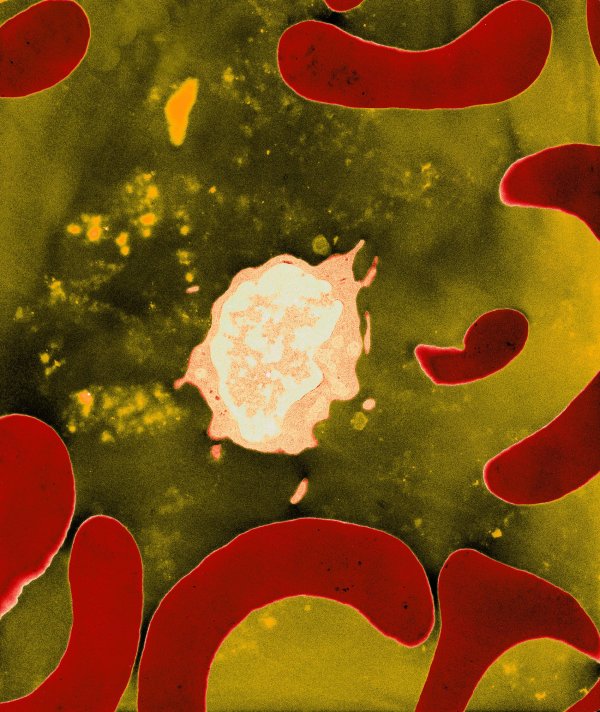 White Blood Cell Count in Malaria Study Group | Infectious Diseases ...